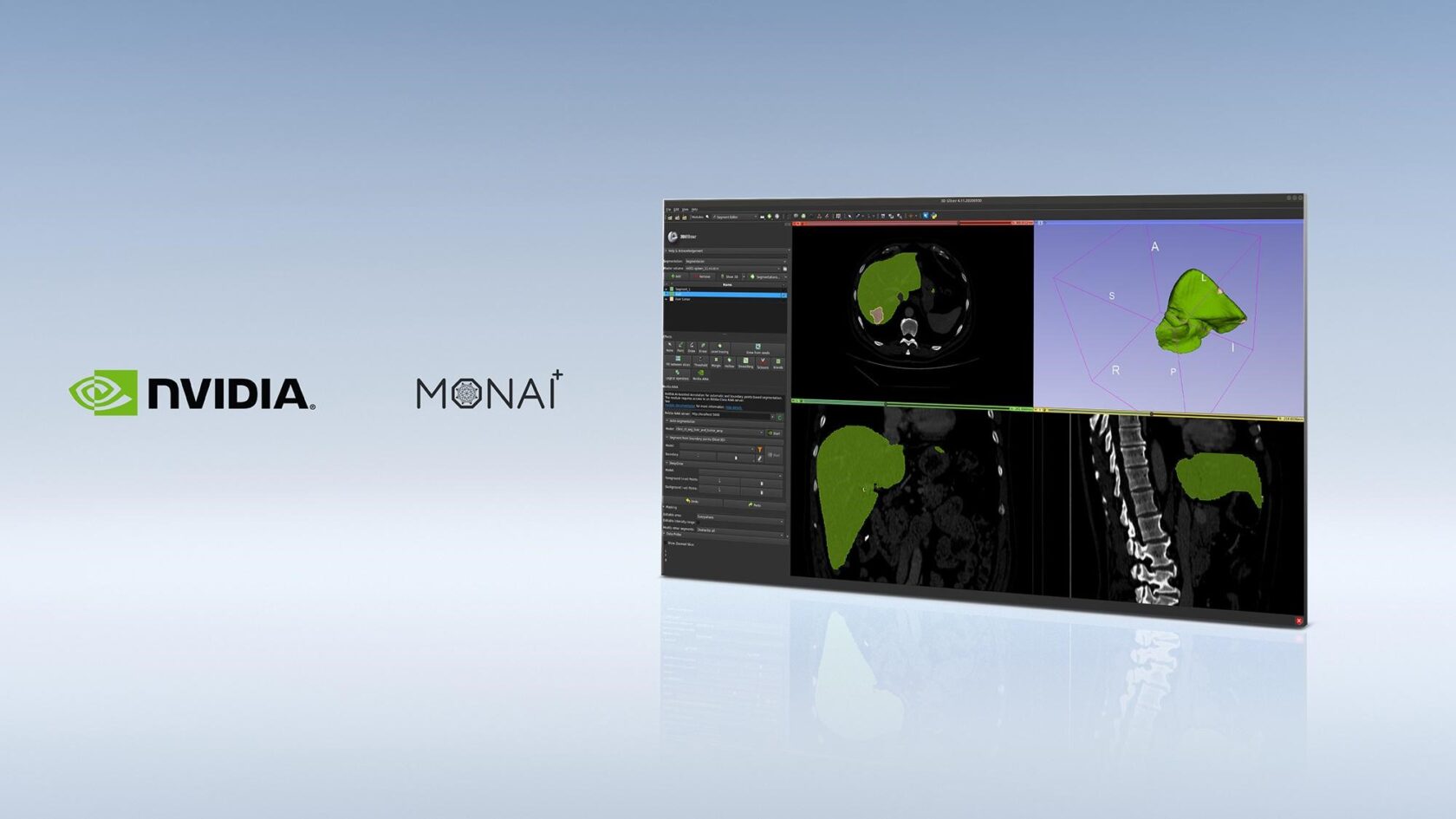 MONAI Imaging Framework Fast-Tracked to Production | NVIDIA Blog
