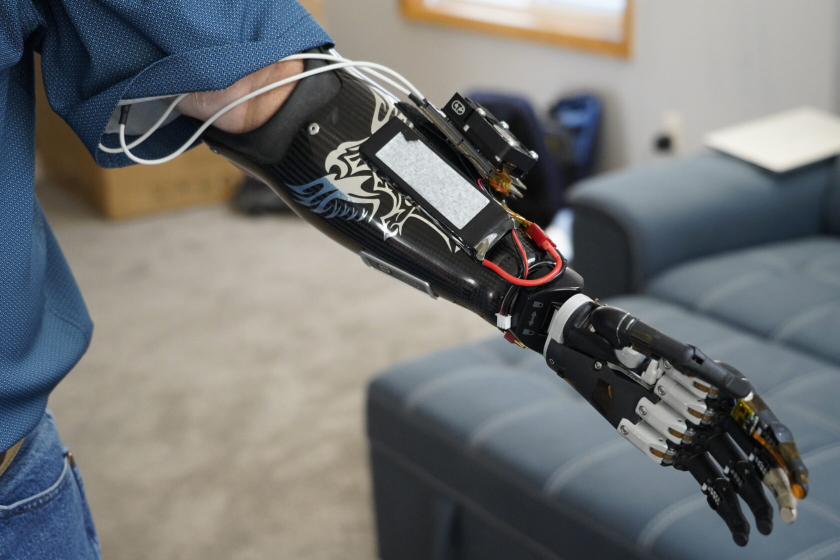 First-Hand Experience: Deep Learning Lets Amputee Control Prosthetic ...