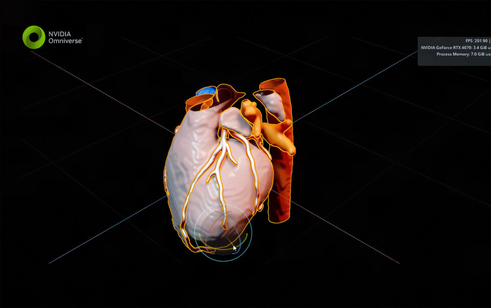 Foxconn Accelerates Robotics for Global Healthcare Industry | NVIDIA Blog